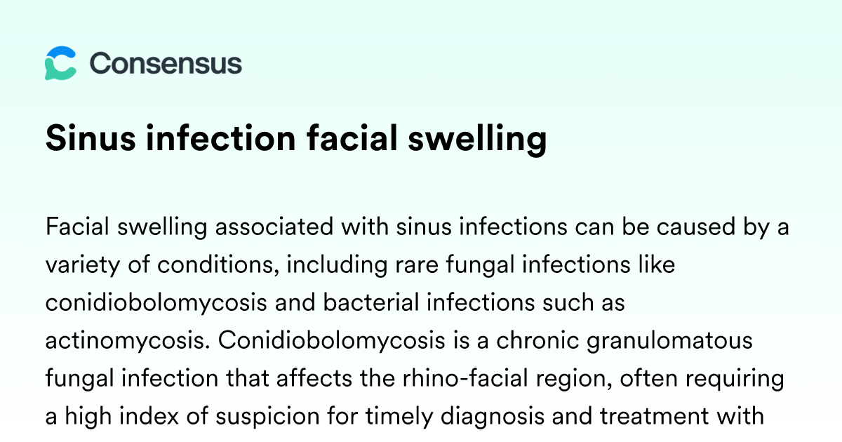 Sinus Infection Facial Swelling - Consensus Academic Search Engine