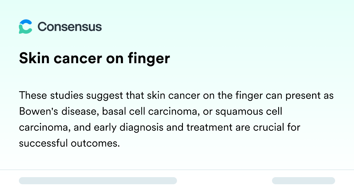 Skin Cancer On Finger - Consensus Academic Search Engine